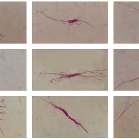 Examples Of Nine Different Pacemaker Cells Left And Middle Top