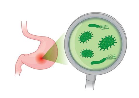 Helicobacter Pylori Illustrations Royalty Free Vector Graphics And Clip Art Istock