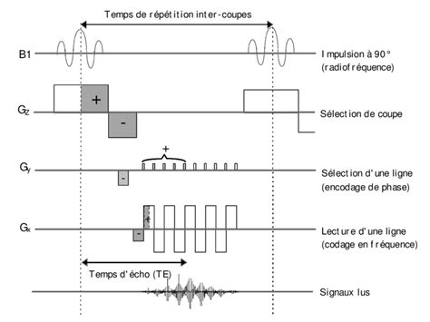 Séquence Dacquisition Echo Planar En écho De Gradient Download Scientific Diagram