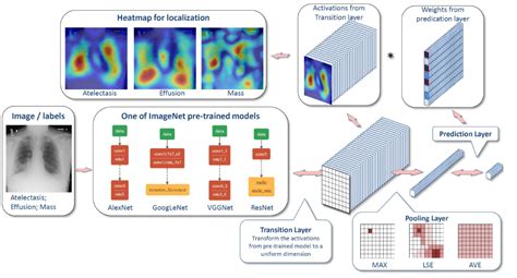 Review — Chestx Ray8 Hospital Scale Chest X Ray Database And