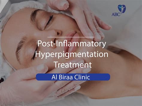 Understanding And Treating Post Inflammatory Hyperpigmentation