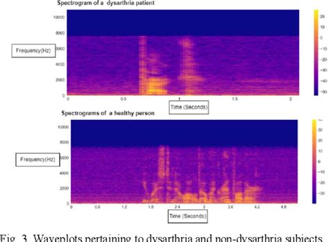 Figure 1 From Using Novel Hybrid Convolutional Neural Network For Dysarthria Diagnosis
