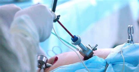 Diagnostic Laparoscopy Procedure Dr Sarada