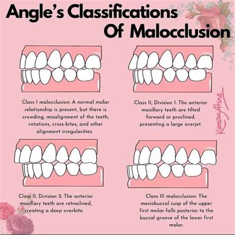 Angles Classification Medizzy