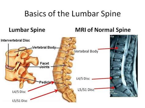 Lumbopelvic Rhythm Physiopedia
