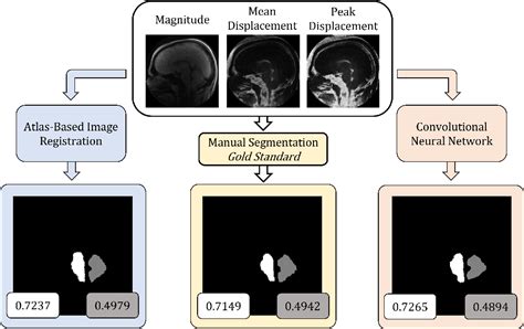 Figure From Comparison Of Atlas Based And Neural Network Based Semantic Segmentation For Dense