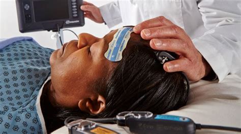 Cerebral And Tissue Oximetry Nonin