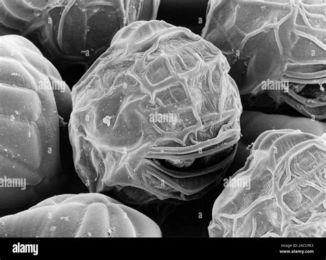 Scanning Electron Micrograph Of Sporangia Of The Common Polypody Fern
