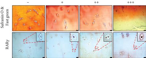 Rarγ Was High Expression In Human Oa Chondrocytes Compared With Normal Download Scientific