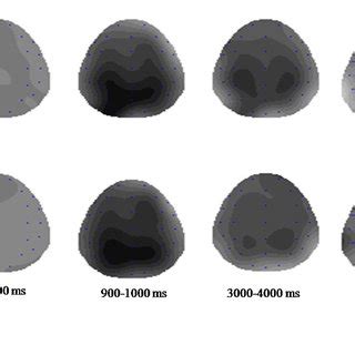 The Scalp Topographies For Positive Pictures During The Late Follicular Download Scientific