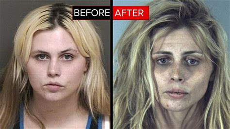 9 Common Abusive Drugs That Have Absolutely Horrific Effects