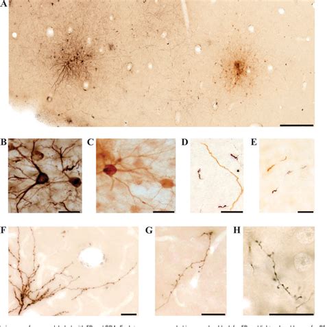 Figure 1 From Functional Selectivity Of Interhemispheric Connections In