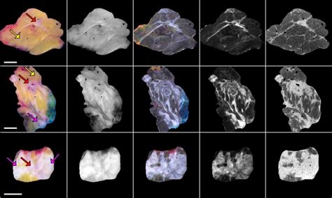 Deep Learning Improves Multimodality Imaging For Breast Cancer