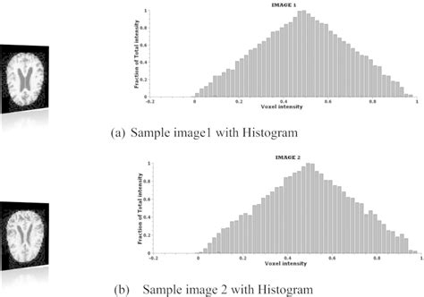 sample adaptive histogram equalization ahe results a sample image download scientific