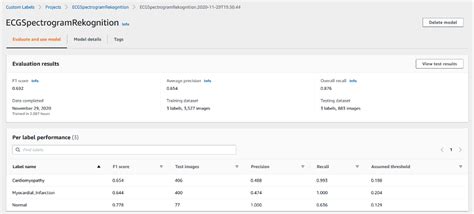 Aws Cloud Technology For Near Real Time Cardiac Anomaly Detection Using