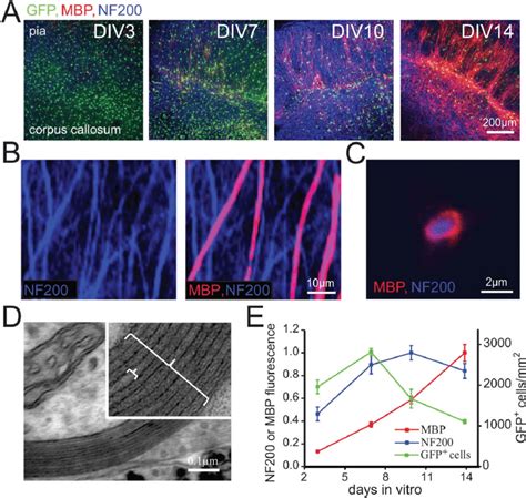 Development Of Myelination In Cultured Cortical Slices A Cortical