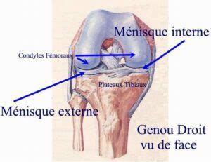 Quel Sport Avec Ménisque Fissuré Tu Vas Le Savoir Ici