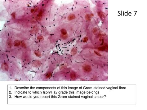 Ppt Test Your Ability To Read Gram Stained Genital Samples Powerpoint