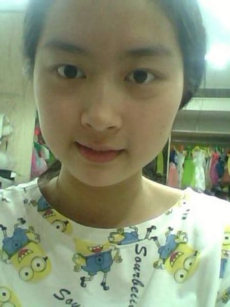 咬肌明显的图片 有来医生