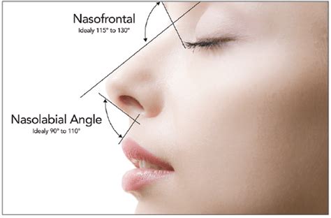 A Review Of Non Surgical Rhinoplasty Prime Journal