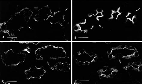 Composite Plate Showing The Inner Stripe Of The Outer Medulla A B Download Scientific