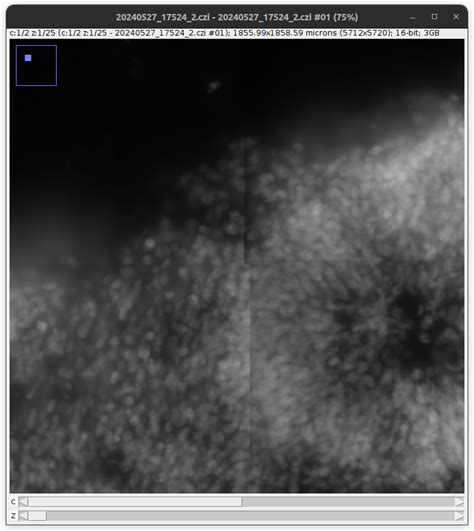 Understanding Czi Tiles Structure And Accessing Single Tiles Usage And Issues Imagesc Forum