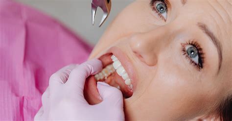 걱정 건강 건강 서비스 구강 건강 구강 수술 돌보다 두려움 발치 성인 환자 순서 시험 악기 안전 여성 여성 환자 의료 의료 절차 이 입