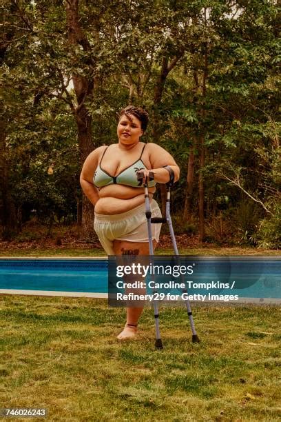 Woman With Missing Limb Photos And Premium High Res Pictures Getty Images