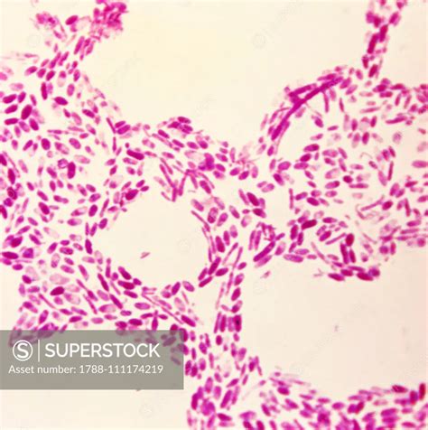 Acetobacter Bacteria Seen Under A Microscope With Counterstaining At