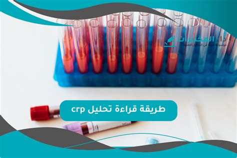 تحليل Lymphocytes المعدل الطبيعي نسبة الارتفاع والانخفاض دار المختبرات