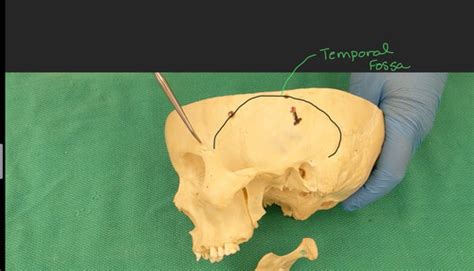 16 Infratemporal Fossa Musclesandvessels Flashcards Quizlet