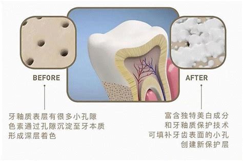 14天告别小黄牙，怎么笑都好看 物道 崇真艺客