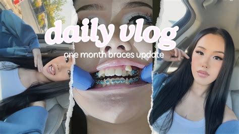 Braces Vlog Ep3 One Month Braces Update Come With Me To My Orthodontist Vlog♡ Youtube
