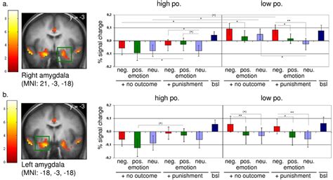 Statistical Parametric Map And Percent Signal Change Derived From The Download Scientific