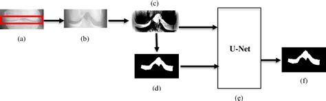 Figure 3 From Knee Osteoarthritis Automatic Detection Using U Net Semantic Scholar