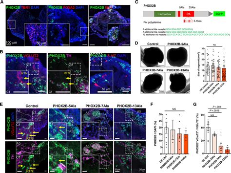 Phox2b Parms Disrupt The Formation Of Respiratory Center Like Region Download Scientific