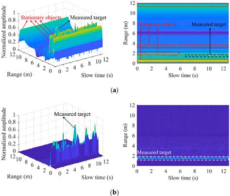 Figure 1 From High Precision Vital Signs Monitoring Method Using A Fmcw Millimeter Wave Sensor