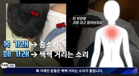 코로나 오미크론 후유증 기침 가래로 고생하고 있다면 이것 드세요 완벽하게 치유됩니다