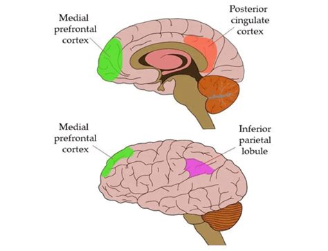 Adhd Vs Neurotypical Brains Mental Health Academy