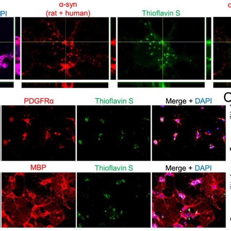 P α Syn Immunoreactive Inclusions Were Present In The Cytoplasm Of Download Scientific Diagram