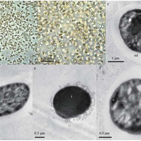 Pdf Morphology Ultrastructure And Phylogeny Of Cyanothece Sp Cyanobacteriaceae