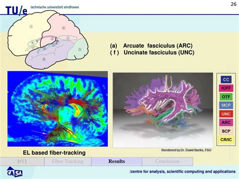 PPT Multi Valued Geodesic Based Fiber Tracking For Diffusion Tensor Imaging PowerPoint