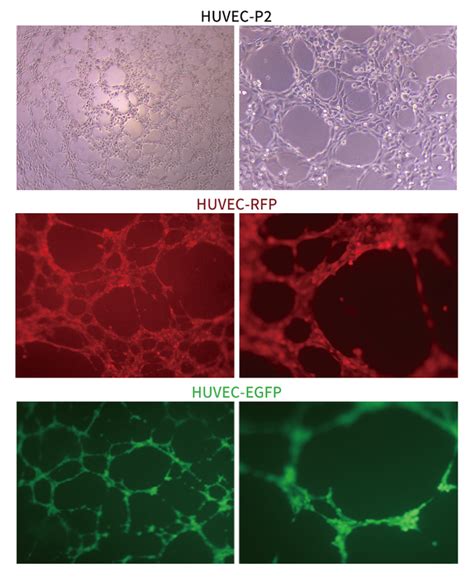 一步步教你掌握huvec血管生成实验：从理论到操作全覆盖！ 知乎
