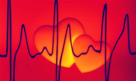 Similar Safety And Efficacy Observed In Two Drug Types During Catheter Ablation Of Atrial