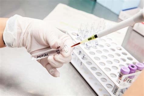 How Much Od Do You Actually Need For Flow Cytometry Omega Optical