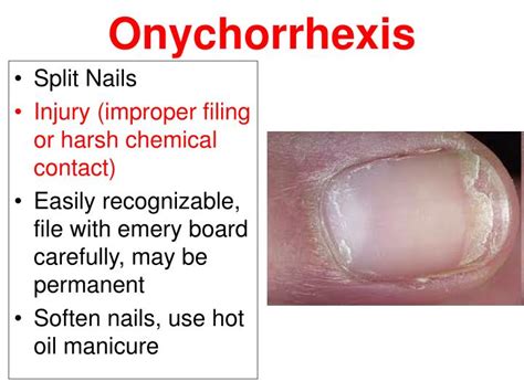 Ppt Nail Theory Powerpoint Presentation Id2742453