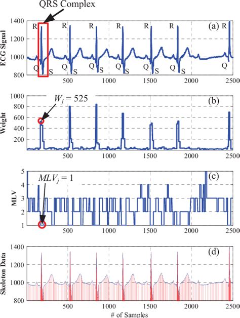 Figure 1 From A Novel Approach For Ecg Data Compression In Healthcare
