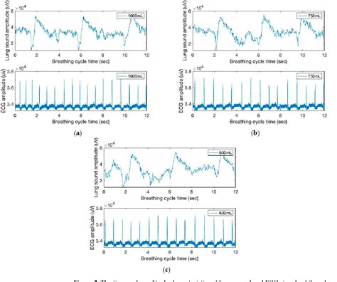 Figure 2 From A Wearable Multimodal Wireless Sensing System For