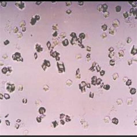 Insulin Manufacturing Process Flow For This Manuscript Two Different Download Scientific