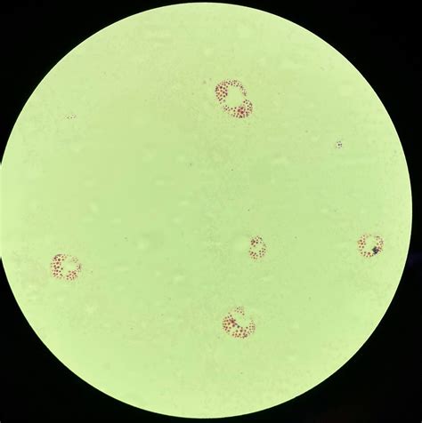 Christine F On Linkedin Crypto Cryptococcus Cryptococcusneoformans Underthemicroscope…